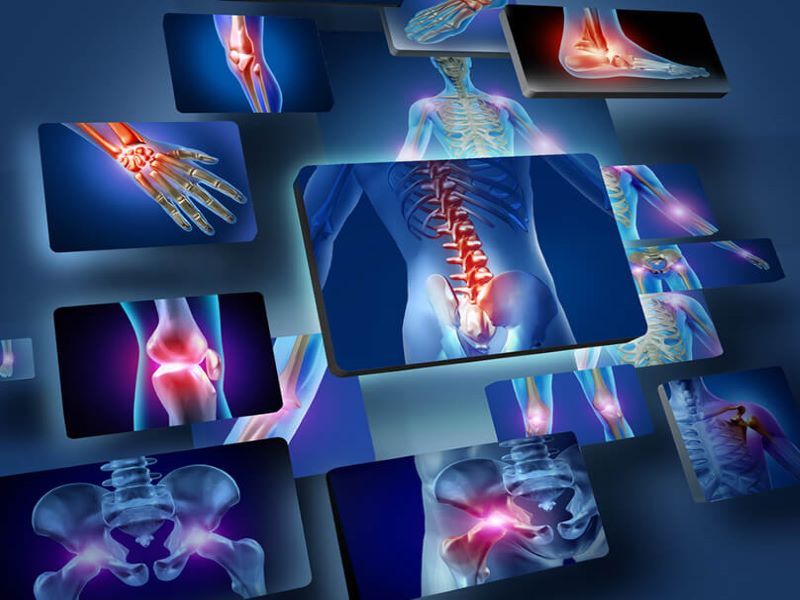 Συστηματικός Ερυθηματώδης Λύκος: Η έγκαιρη διάγνωση και θεραπεία σώζει ...